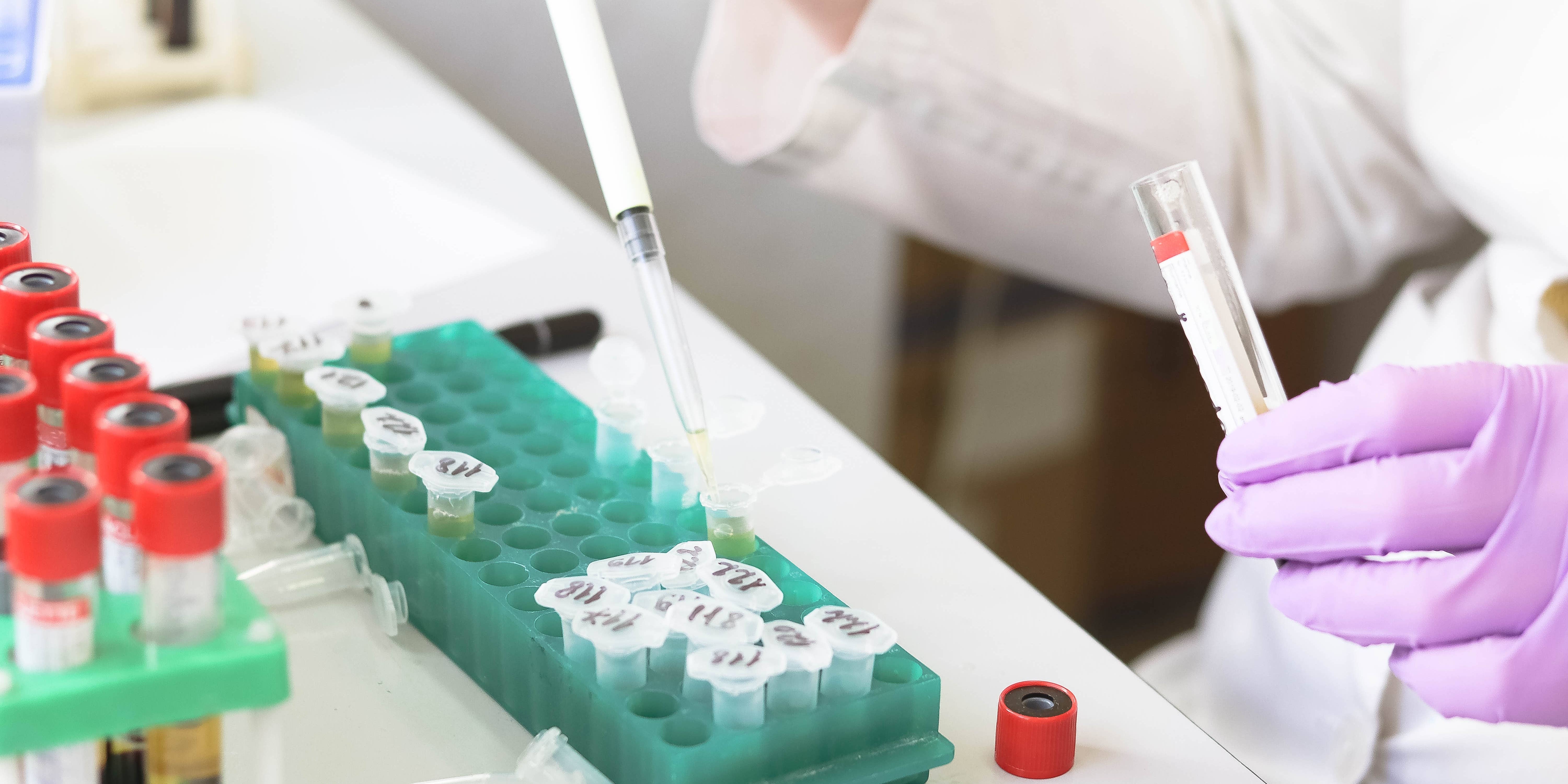 Lab Technician Interview Questions