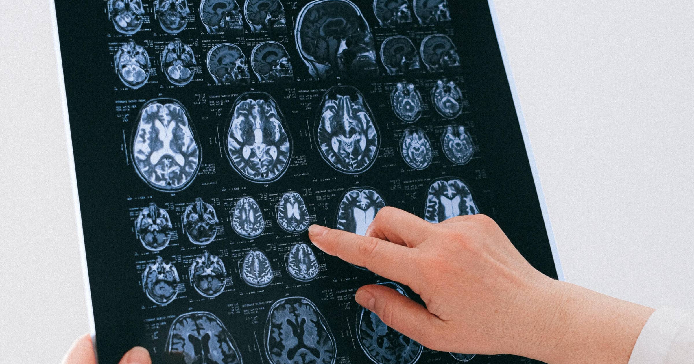 Neurologist Job Description